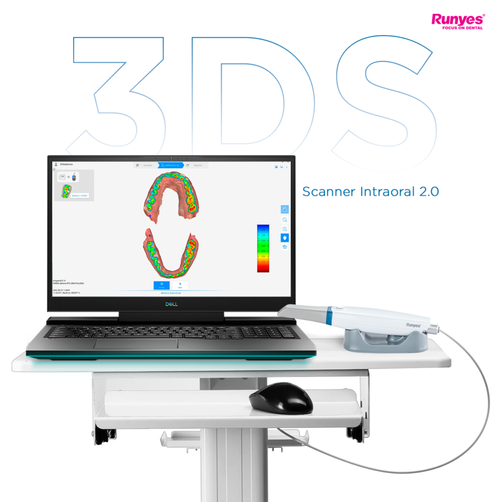 Escaner Intraoral 3DS Runyes - Laboratorios Gayz